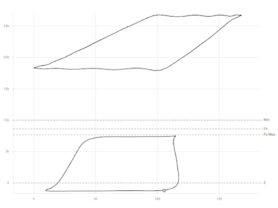 Rod Lift Optimization with AI-Powered Dynacard Classification