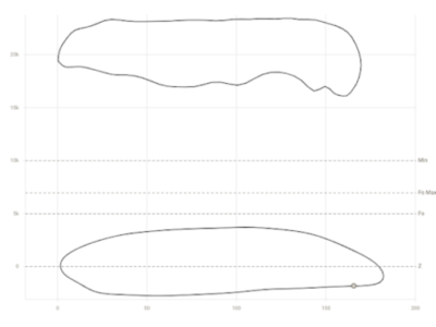Rod Lift Optimization with AI-Powered Dynacard Classification